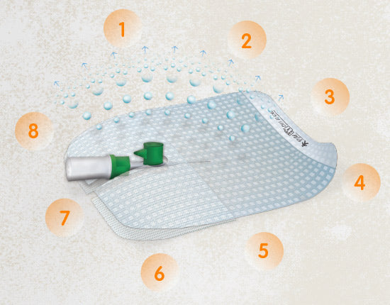 Smith&Nephew IV3000 – Sheridan Surgical